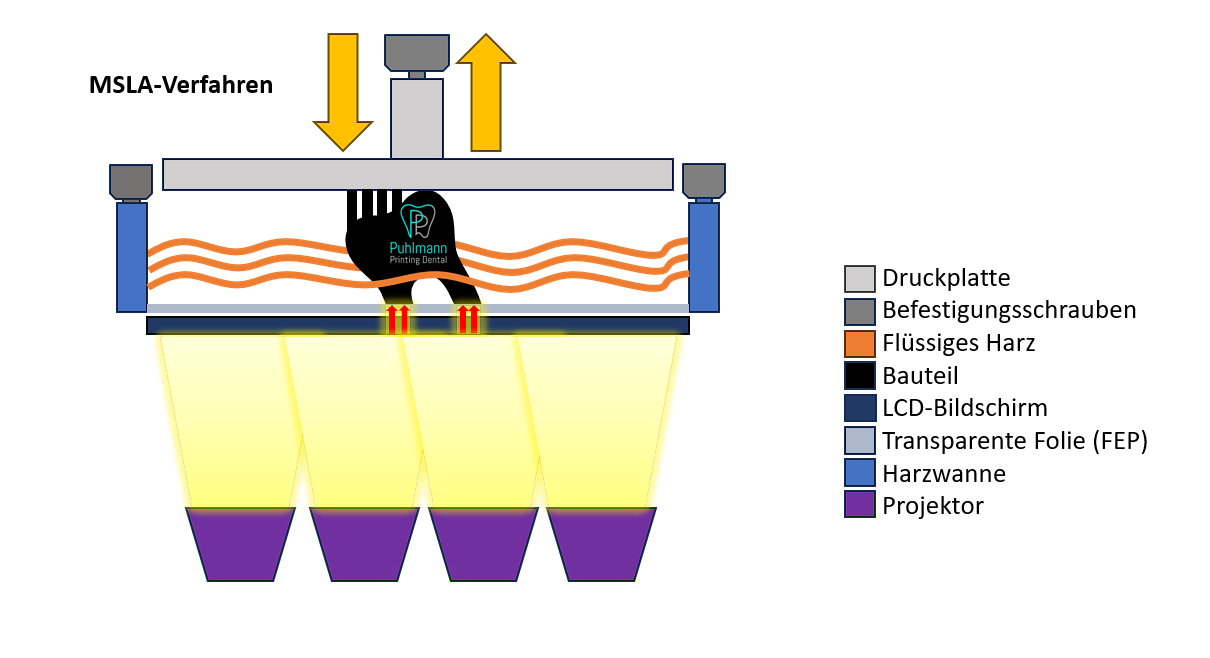 MSLA-Verfahren - Puhlmann Printing - Dental